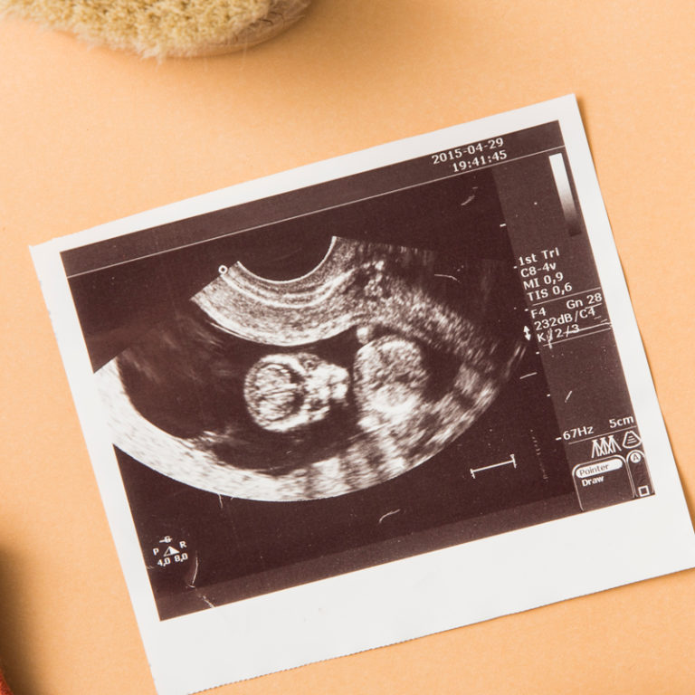 The Anatomy Scan Ultrasound Is An Amazing Experience You ll Get A 