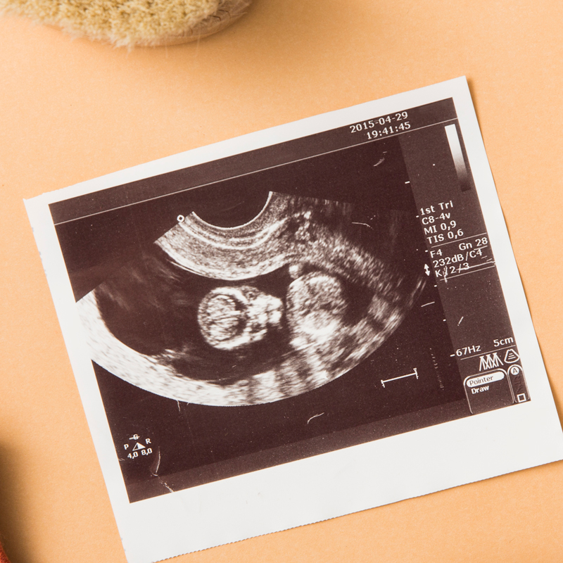 The Anatomy Scan Ultrasound Is An Amazing Experience You ll Get A The Anatomy Scan Ultrasound Is An Amazing Experience You ll Get A